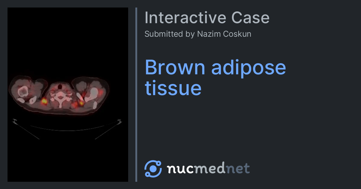 Brown adipose tissue · nucmed.net