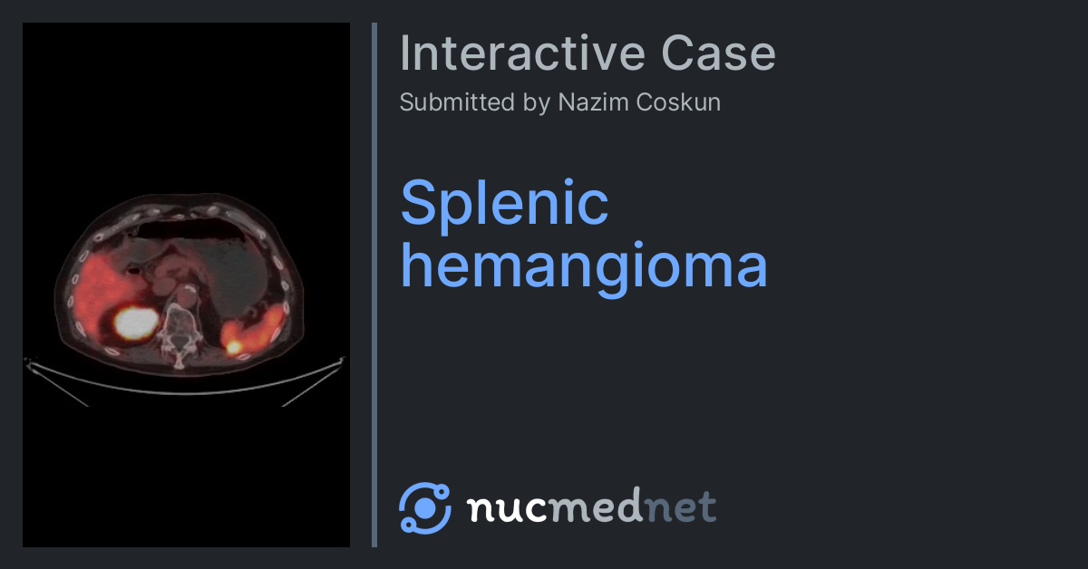 Splenic hemangioma · nucmed.net